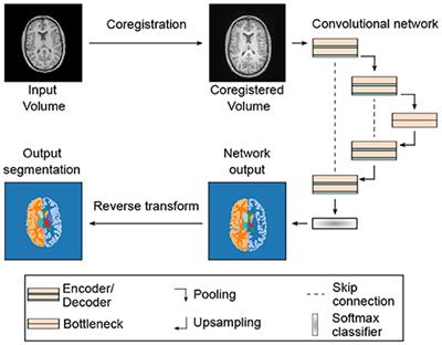 Frontiers | Multi-Modal Segmentation of 3D Brain Scans Using Neural Networks